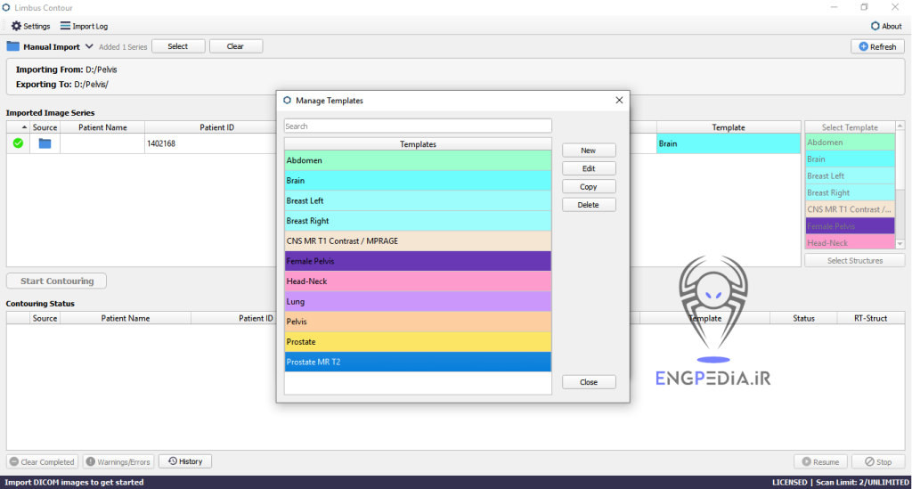 نرم افزار Limbus Contour AI کانتورینگ خودکار پرتودرمانی
