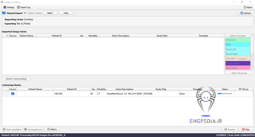 نرم افزار Limbus Contour AI کانتورینگ خودکار پرتودرمانی